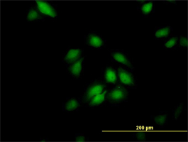PPIE Monoclonal Antibody [2F5] | EpigenTek