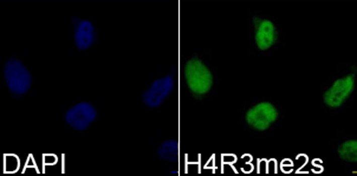 Histone H4R3 Dimethyl Symmetric (H4R3me2s) Polyclonal Antibody | EpigenTek
