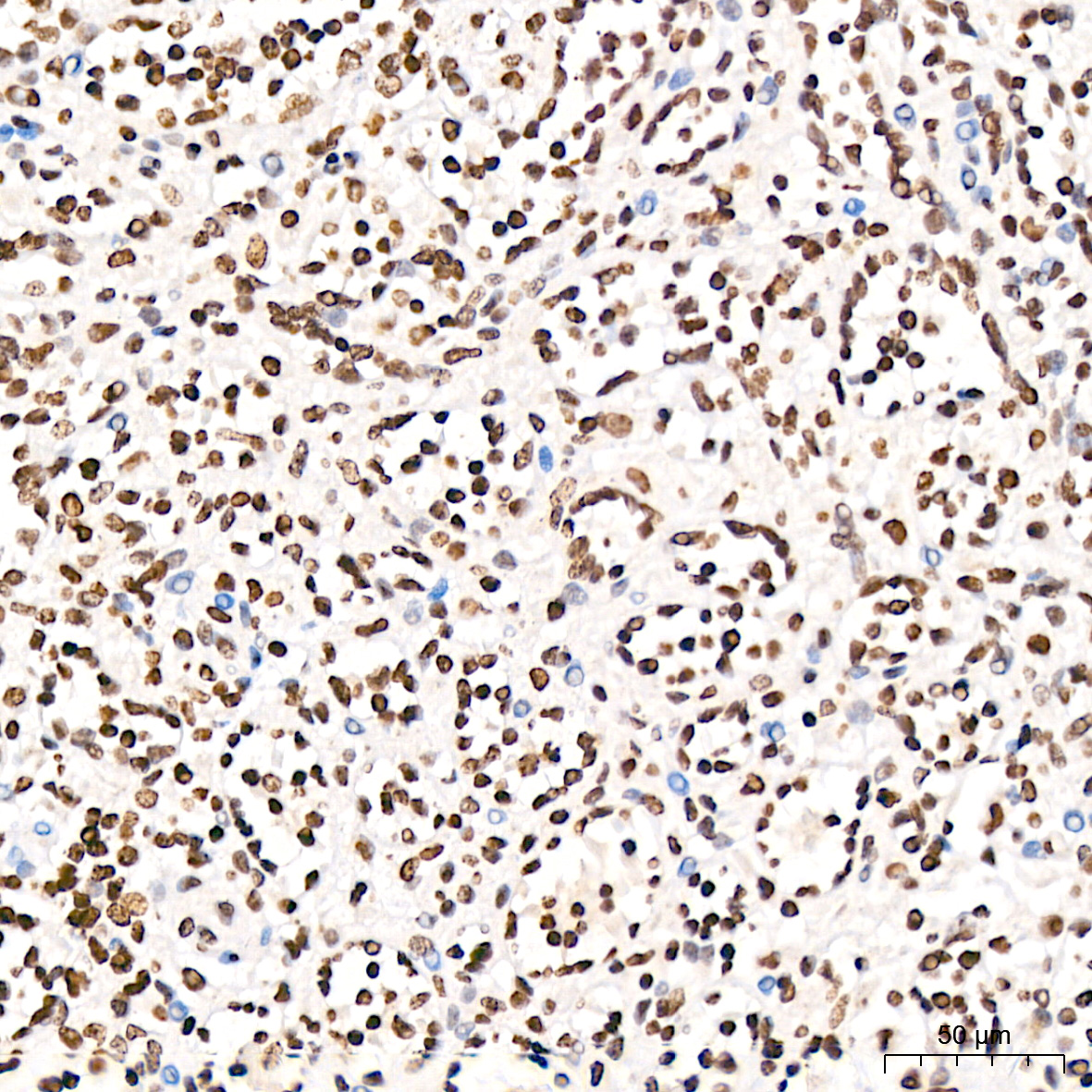 Histone H4R3 Dimethyl Symmetric (H4R3me2s) Polyclonal Antibody | EpigenTek