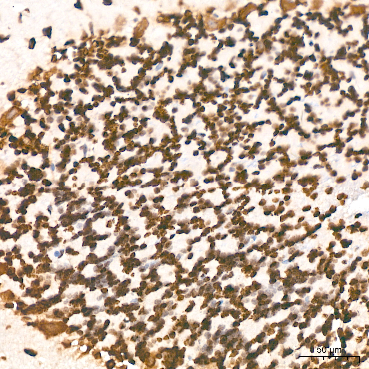 Histone H4R3 Dimethyl Symmetric (H4R3me2s) Polyclonal Antibody | EpigenTek