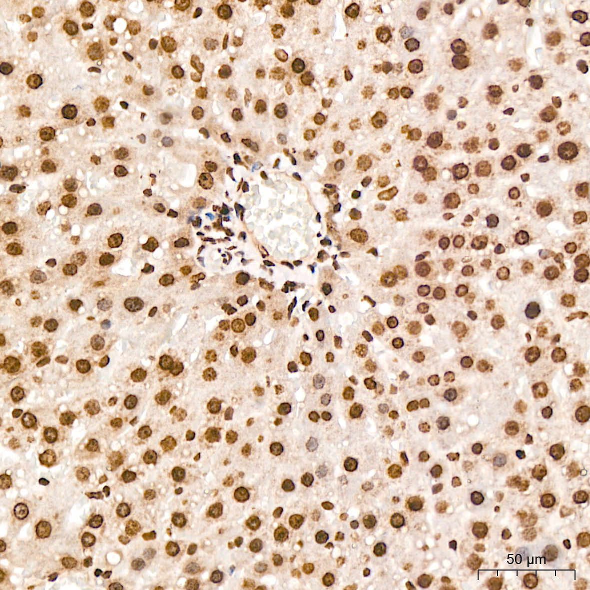 Histone H4R3 Dimethyl Symmetric (H4R3me2s) Polyclonal Antibody | EpigenTek