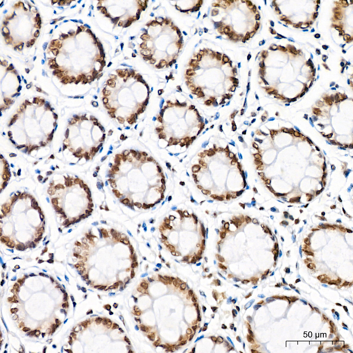 Histone H4R3 Dimethyl Symmetric (H4R3me2s) Polyclonal Antibody | EpigenTek