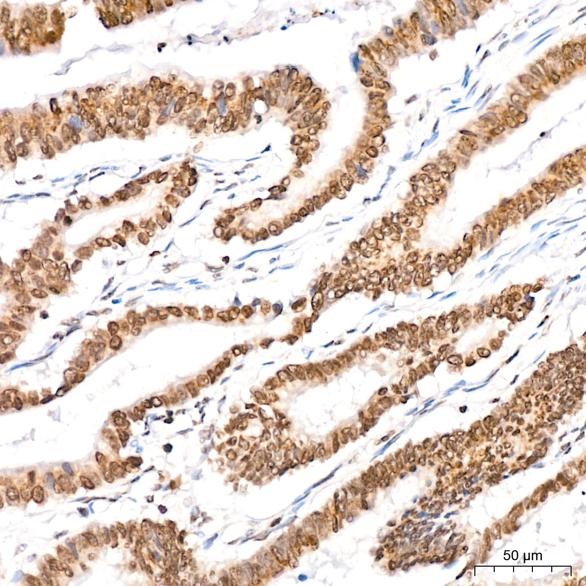 Histone H4R3 Dimethyl Symmetric (H4R3me2s) Polyclonal Antibody | EpigenTek