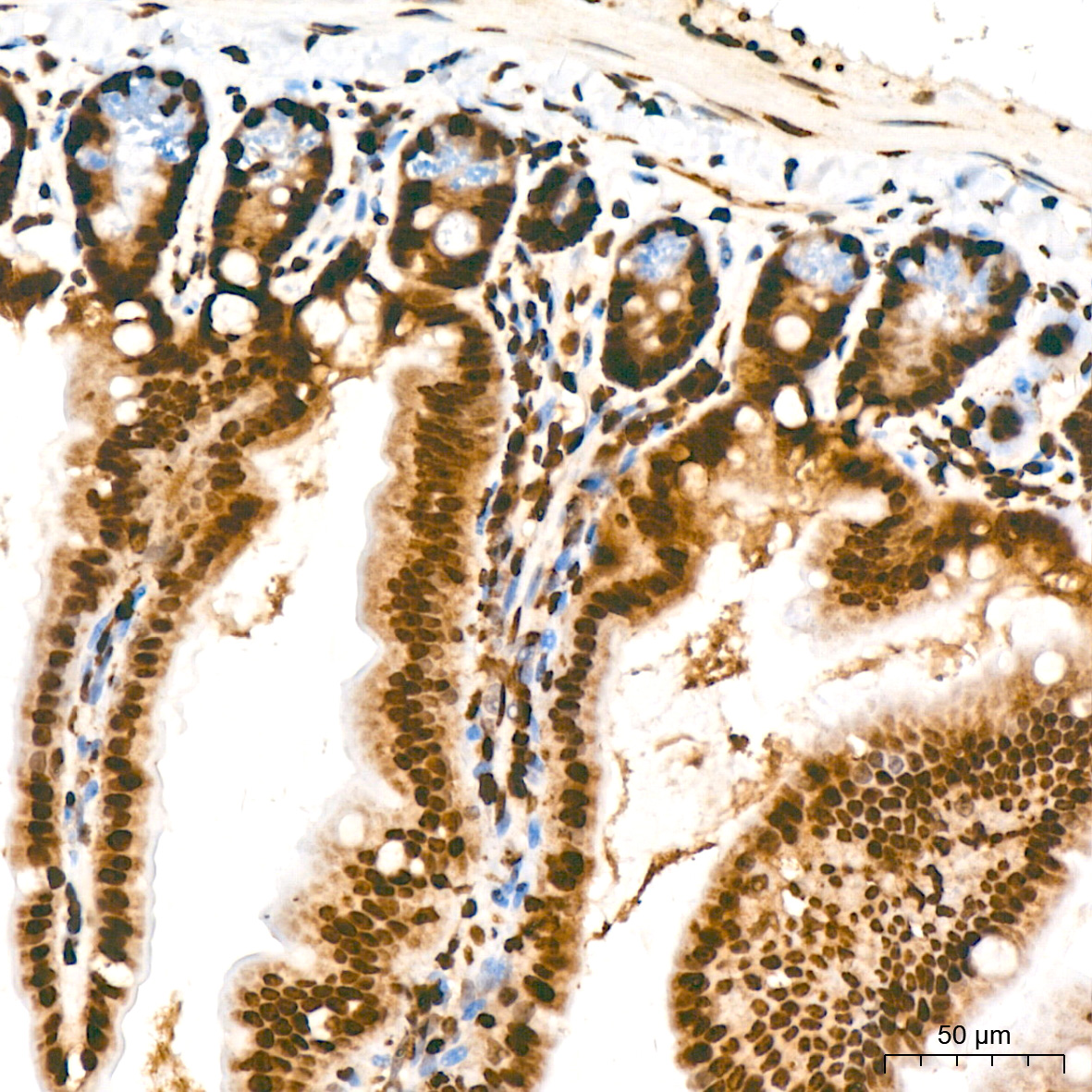 Histone H4R3 Dimethyl Symmetric (H4R3me2s) Polyclonal Antibody | EpigenTek
