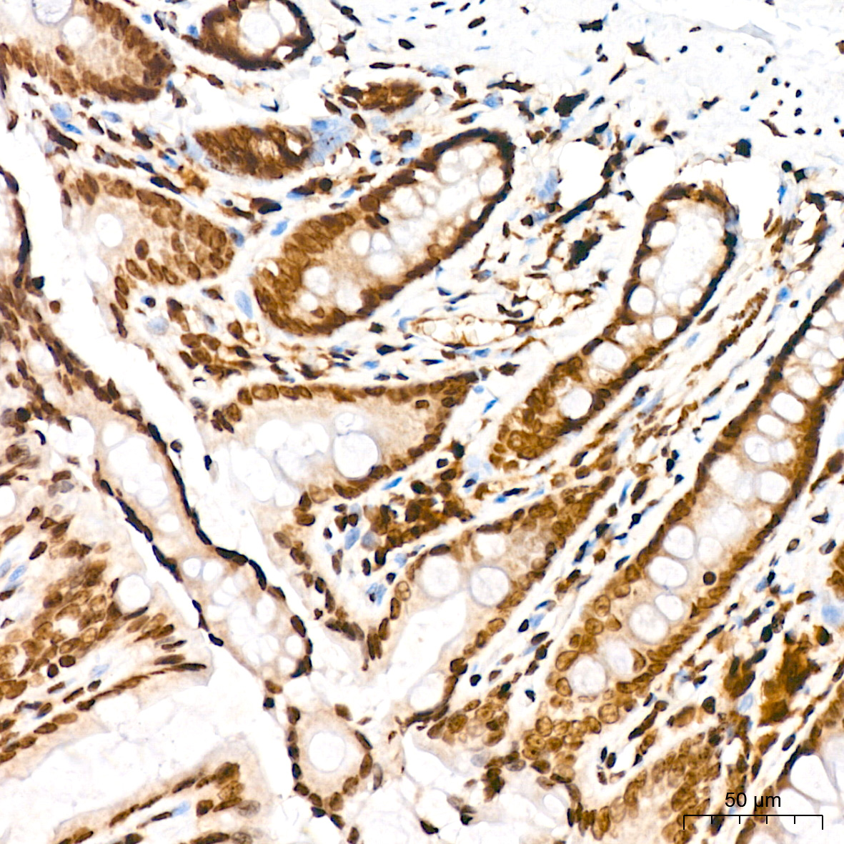 Histone H4R3 Dimethyl Symmetric (H4R3me2s) Polyclonal Antibody | EpigenTek