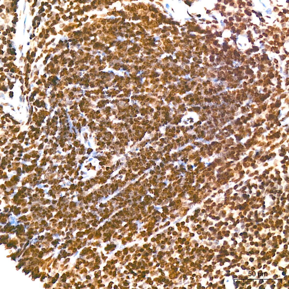 Histone H4R3 Dimethyl Symmetric (H4R3me2s) Polyclonal Antibody | EpigenTek