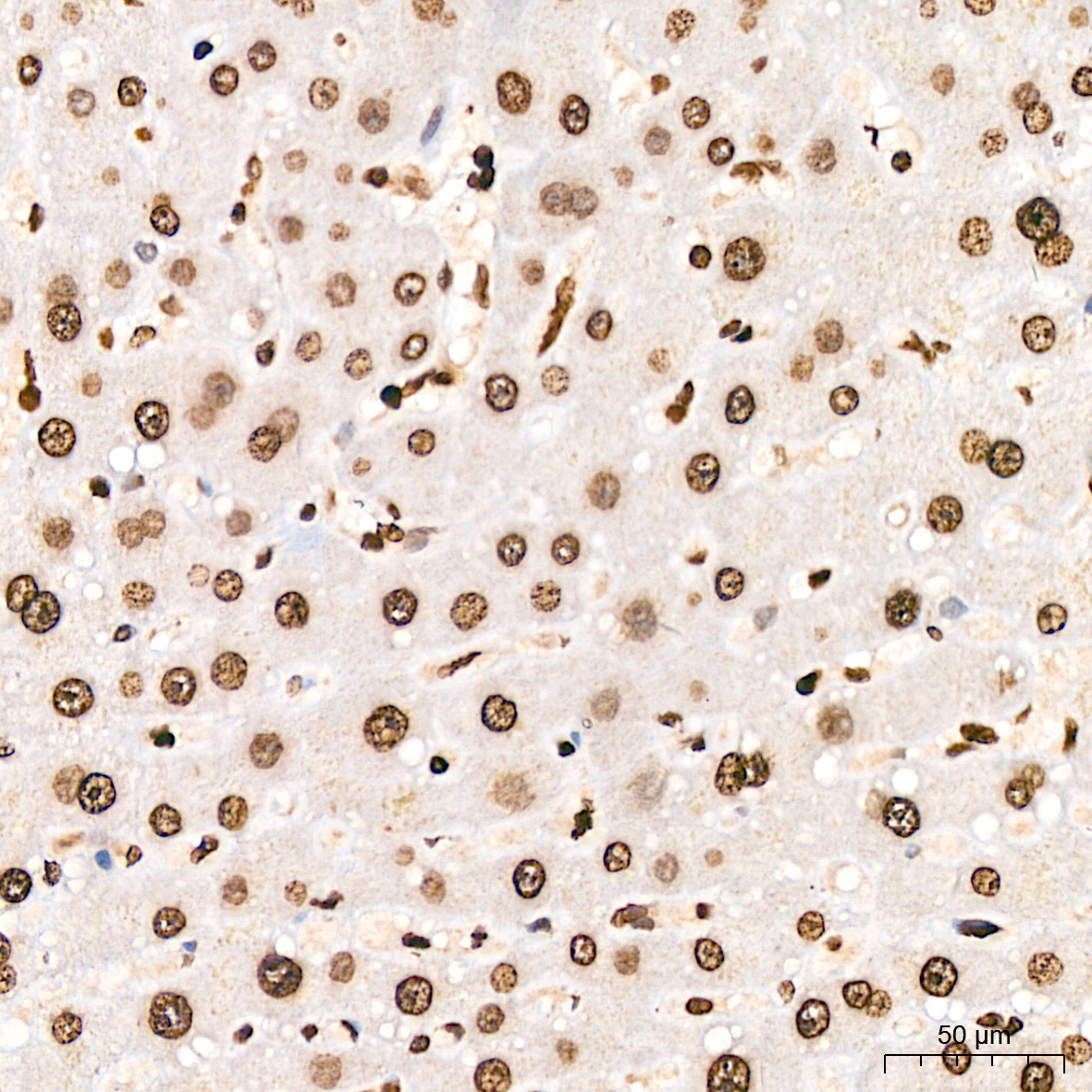 Histone H4R3 Dimethyl Symmetric (H4R3me2s) Polyclonal Antibody | EpigenTek