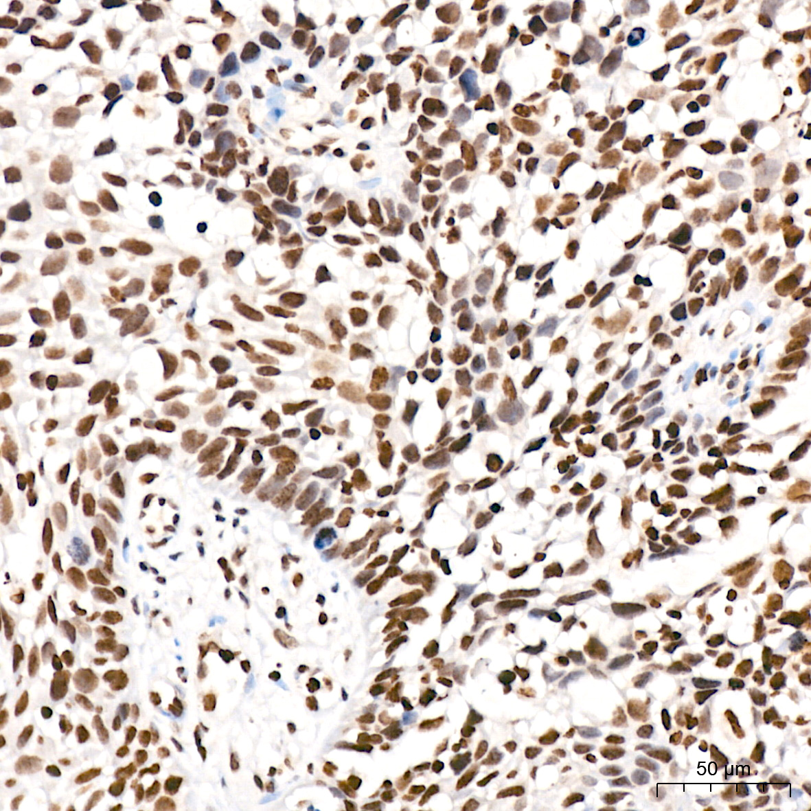 Histone H4R3 Dimethyl Symmetric (H4R3me2s) Polyclonal Antibody | EpigenTek