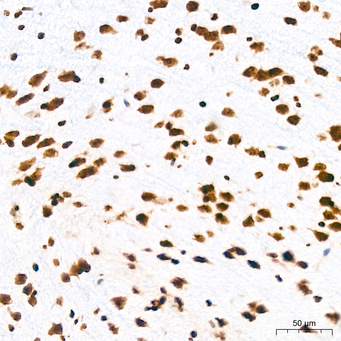 Histone H4R3 Dimethyl Symmetric (H4R3me2s) Polyclonal Antibody | EpigenTek