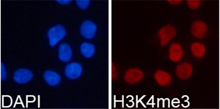 Histone H3K4me3 (H3K4 Trimethyl) Polyclonal Antibody | EpigenTek