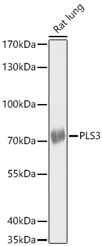 PLS3 Polyclonal Antibody | EpigenTek