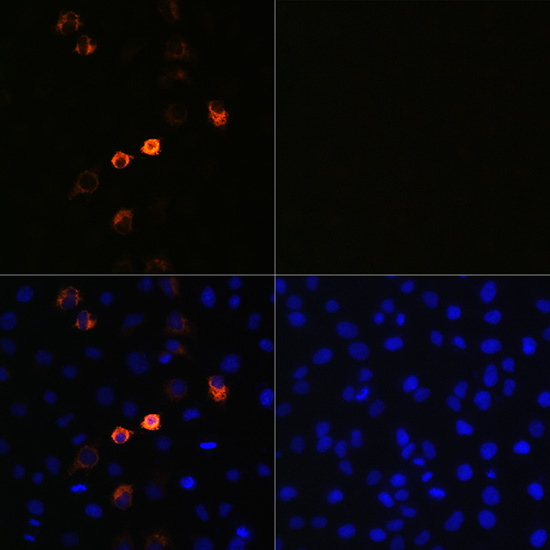 SARS-CoV-2 Spike Monoclonal Antibody | EpigenTek