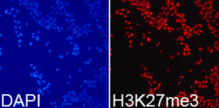 Histone H3K27me3 (H3K27 Trimethyl) Polyclonal Antibody | EpiGentek