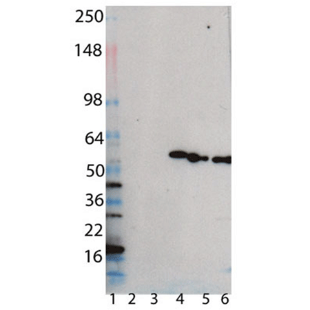 Proteasome 19S Rpn10/S5a subunit Monoclonal Antibody [S5A18] | EpigenTek