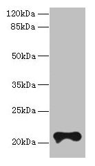 TMEM154 Polyclonal Antibody | EpigenTek