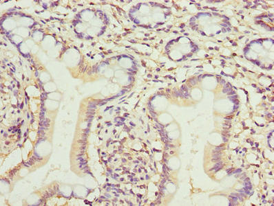 TMEM154 Polyclonal Antibody | EpigenTek