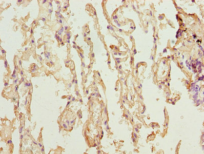 TMEM19 Polyclonal Antibody | EpigenTek