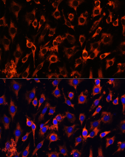 MCTS1 Polyclonal Antibody | EpigenTek