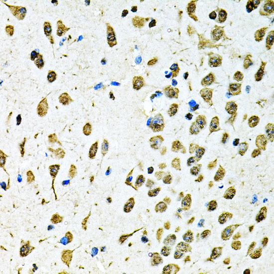 PSMB1 Polyclonal Antibody | EpiGentek