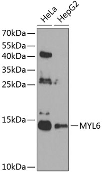 MYL6 Polyclonal Antibody | EpigenTek