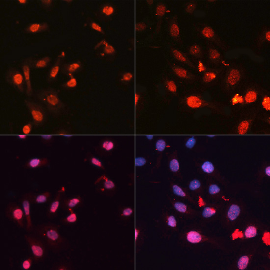 Phospho-Histone H2AX-S139 Polyclonal Antibody | EpiGentek