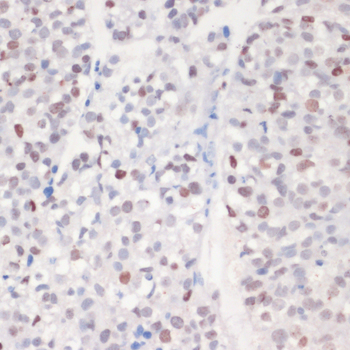 Phospho-Histone H2AX-S139 Polyclonal Antibody | EpiGentek