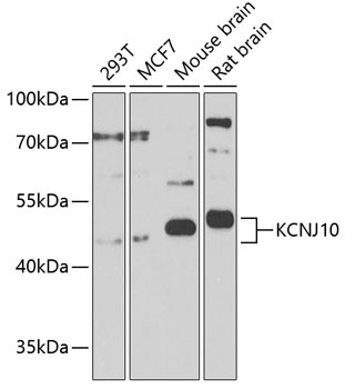 KCNJ10 Polyclonal Antibody | EpigenTek