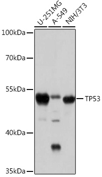 TP53 Polyclonal Antibody | EpigenTek