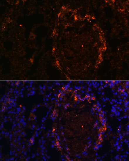 BTN3A1 Polyclonal Antibody | EpigenTek
