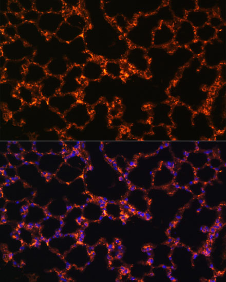 BTN3A1 Polyclonal Antibody | EpigenTek