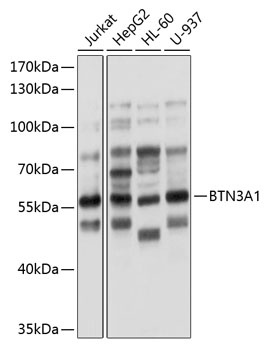 BTN3A1 Polyclonal Antibody | EpigenTek