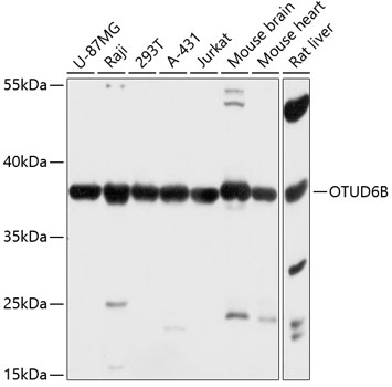 OTUD6B Polyclonal Antibody | EpigenTek