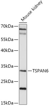 TSPAN6 Polyclonal Antibody | EpigenTek