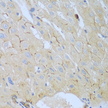 CEACAM7 Polyclonal Antibody | EpiGentek