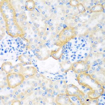 CEACAM7 Polyclonal Antibody | EpiGentek