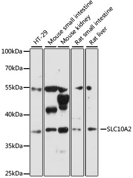 SLC10A2 Polyclonal Antibody | EpigenTek