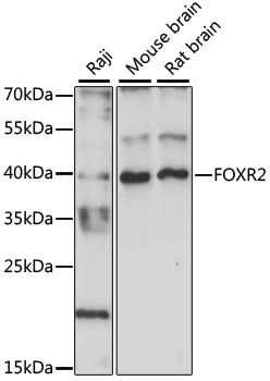 FOXR2 Polyclonal Antibody | EpigenTek