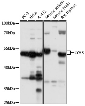 LYAR Polyclonal Antibody | EpigenTek