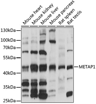 METAP1 Polyclonal Antibody | EpigenTek