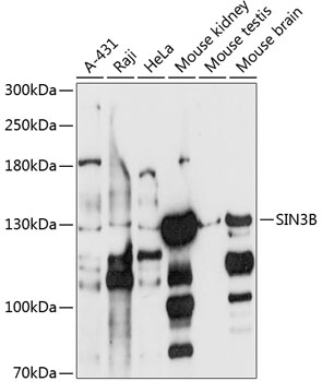 SIN3B Polyclonal Antibody | EpigenTek
