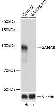 GANAB Polyclonal Antibody | EpigenTek