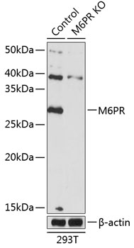 M6PR Polyclonal Antibody | EpigenTek
