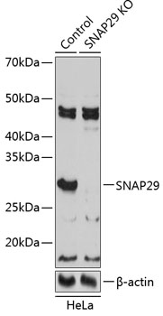 SNAP29 Polyclonal Antibody | EpigenTek