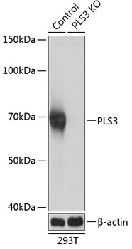 PLS3 Polyclonal Antibody | EpigenTek