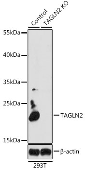 TAGLN2 Polyclonal Antibody | EpigenTek