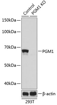 PGM1 Polyclonal Antibody | EpigenTek