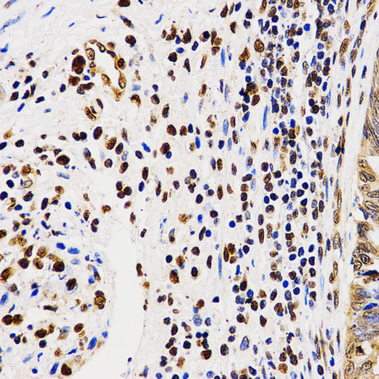 Histone H4R3 Dimethyl Asymmetric (H4R3me2a) Polyclonal Antibody | EpiGentek