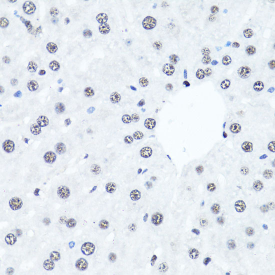 Histone H4R3 Dimethyl Symmetric (H4R3me2s) Polyclonal Antibody | EpiGentek