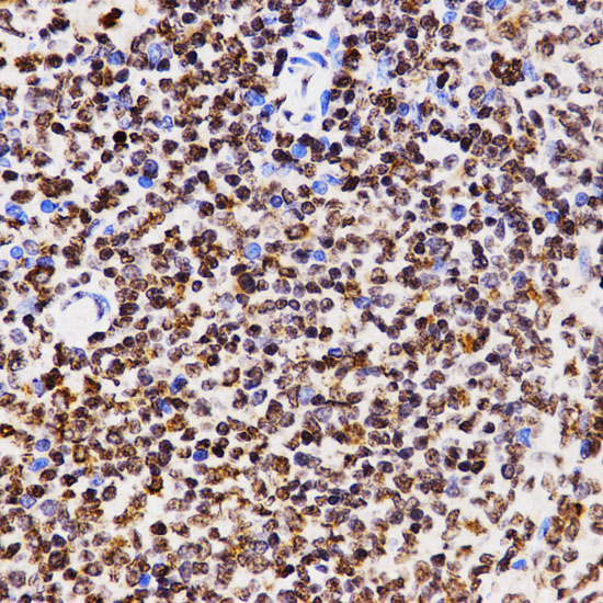 Histone H3K4me1 (H3K4 Monomethyl) Polyclonal Antibody | EpiGentek