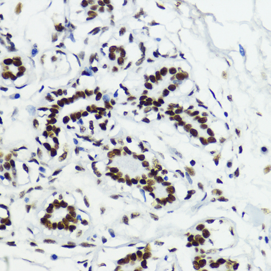 Histone H3K27ac (Acetyl H3K27) Polyclonal Antibody | EpigenTek